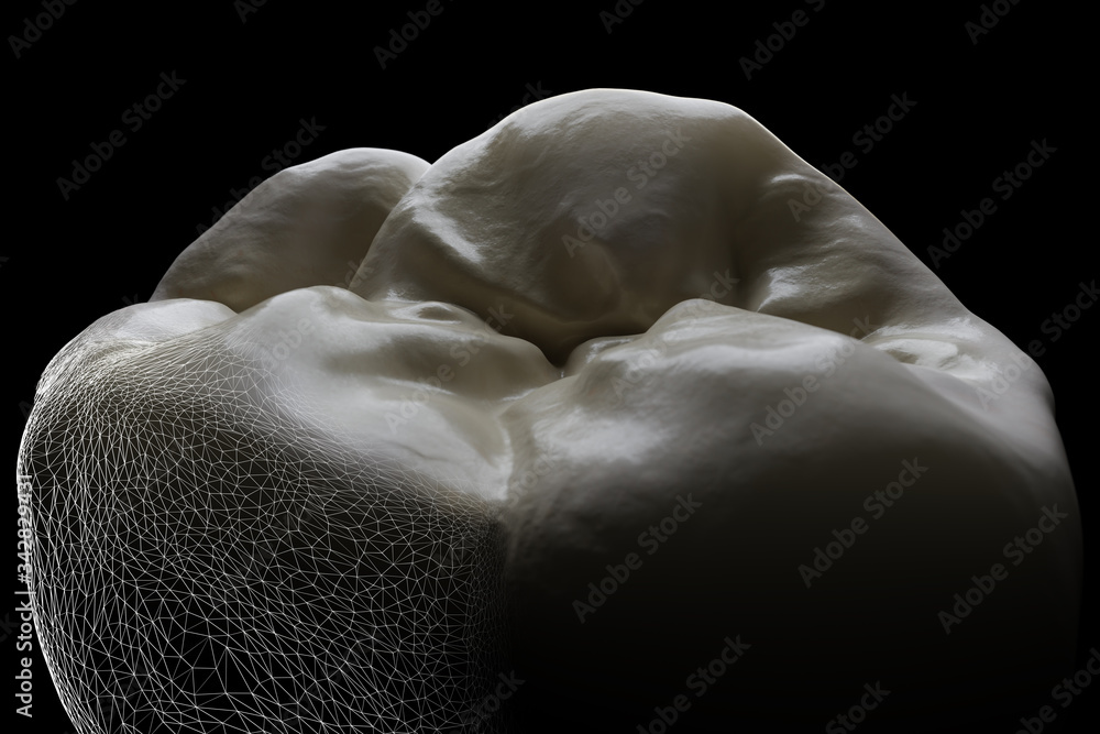 CEREC 3D Scan und Planung für optimalen Zahnersatz | Zahnarzt Ziegler ...